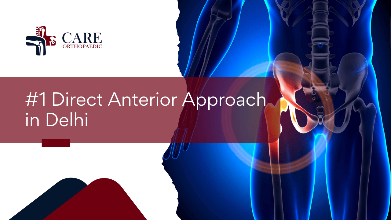 #1 Direct Anterior Approach in Delhi