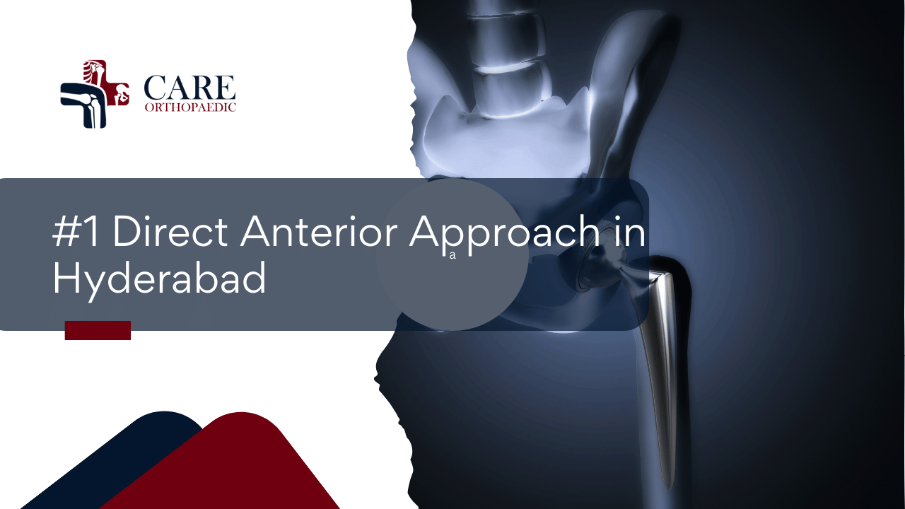 #1 Direct Anterior Approach in Hyderabad