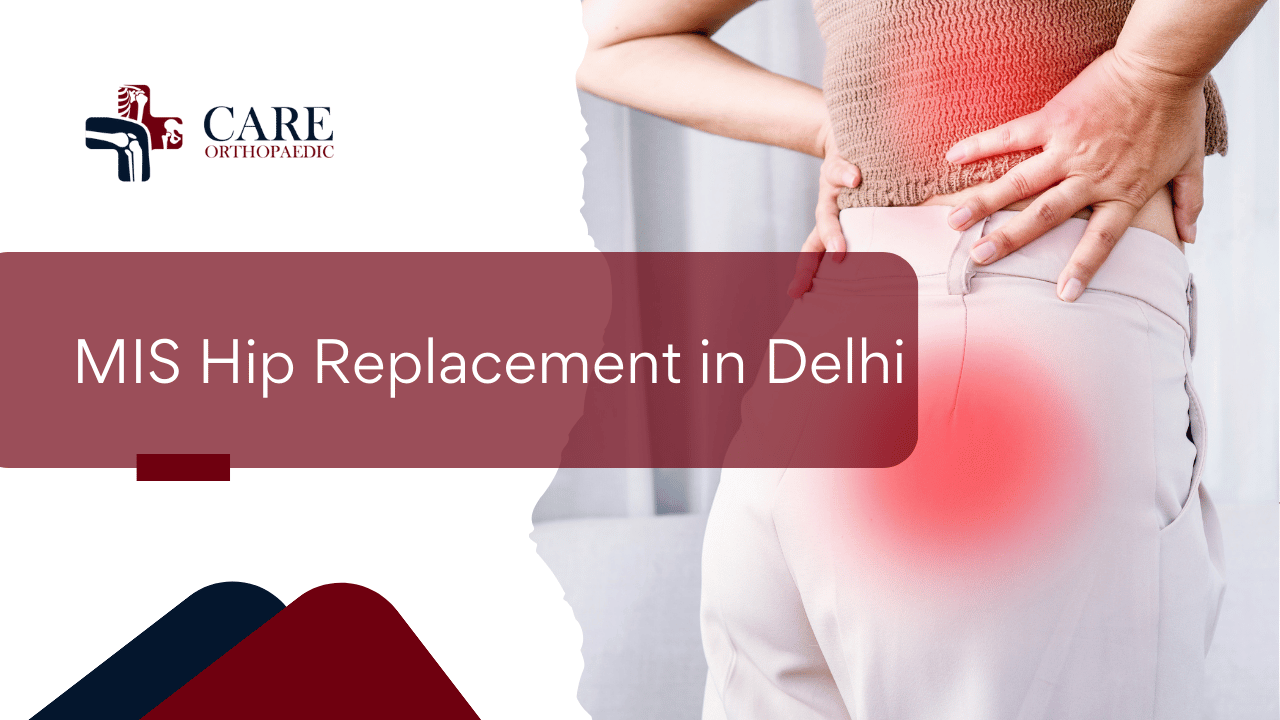 MIS Hip Replacement in Delhi